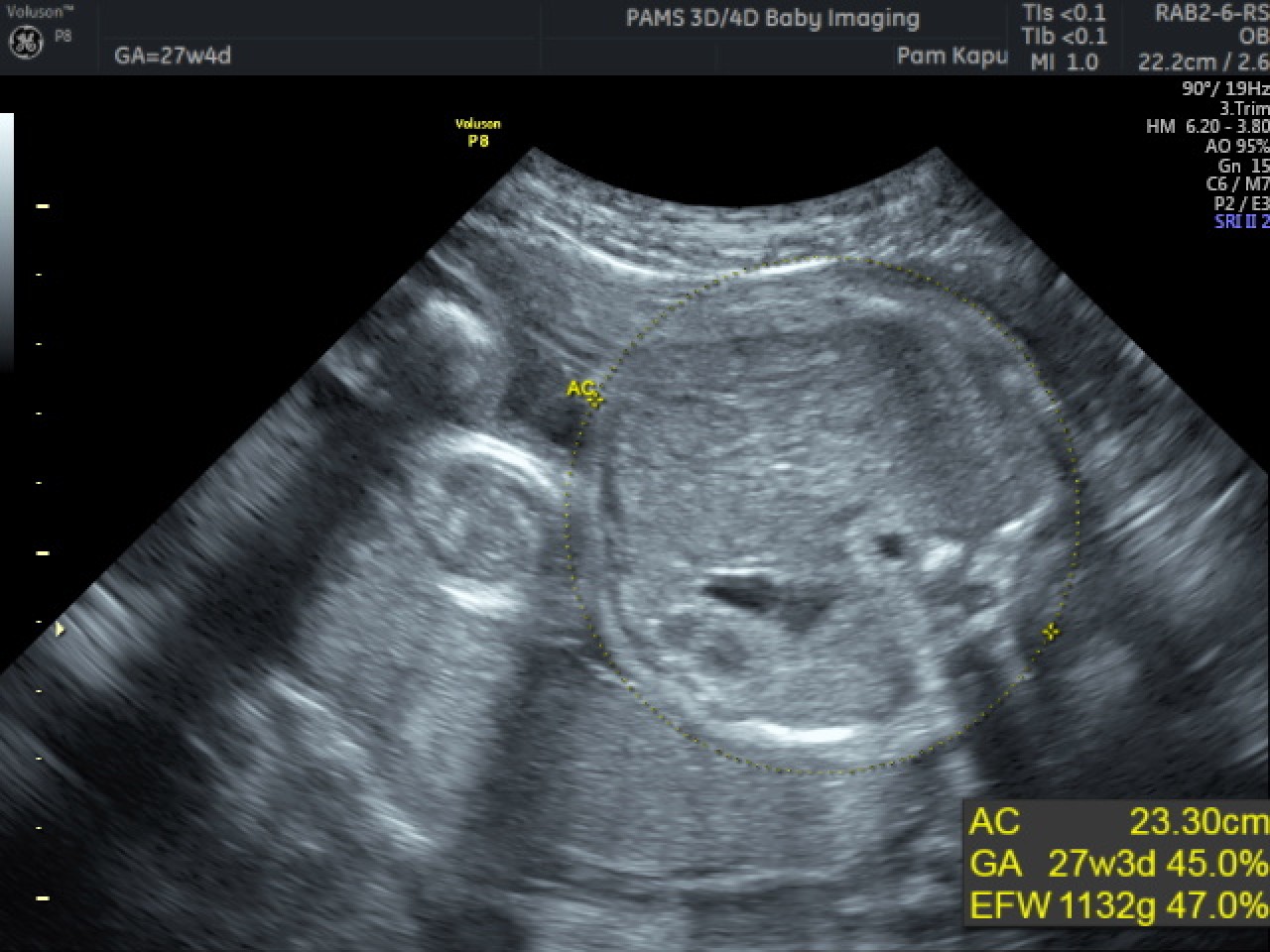 Baby Growth Scan | Private One-On-One Pregnancy & Fertility Ultrasound ...