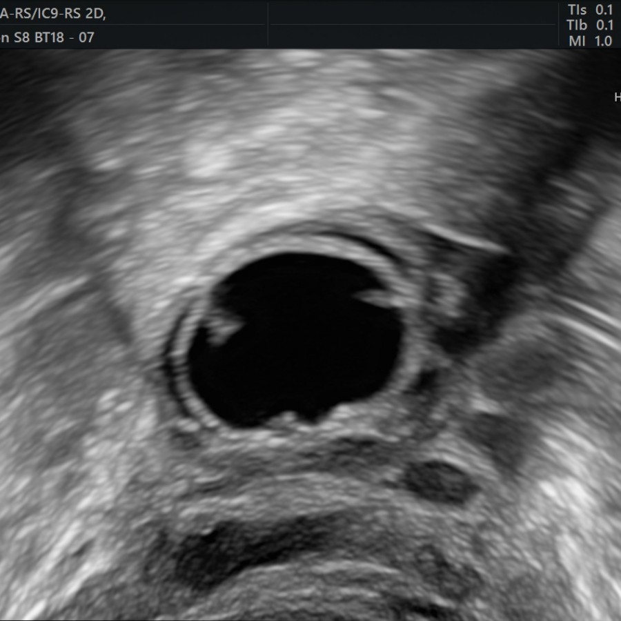 Gynaecological Pelvic Scan | Private One-On-One Pregnancy & Fertility ...