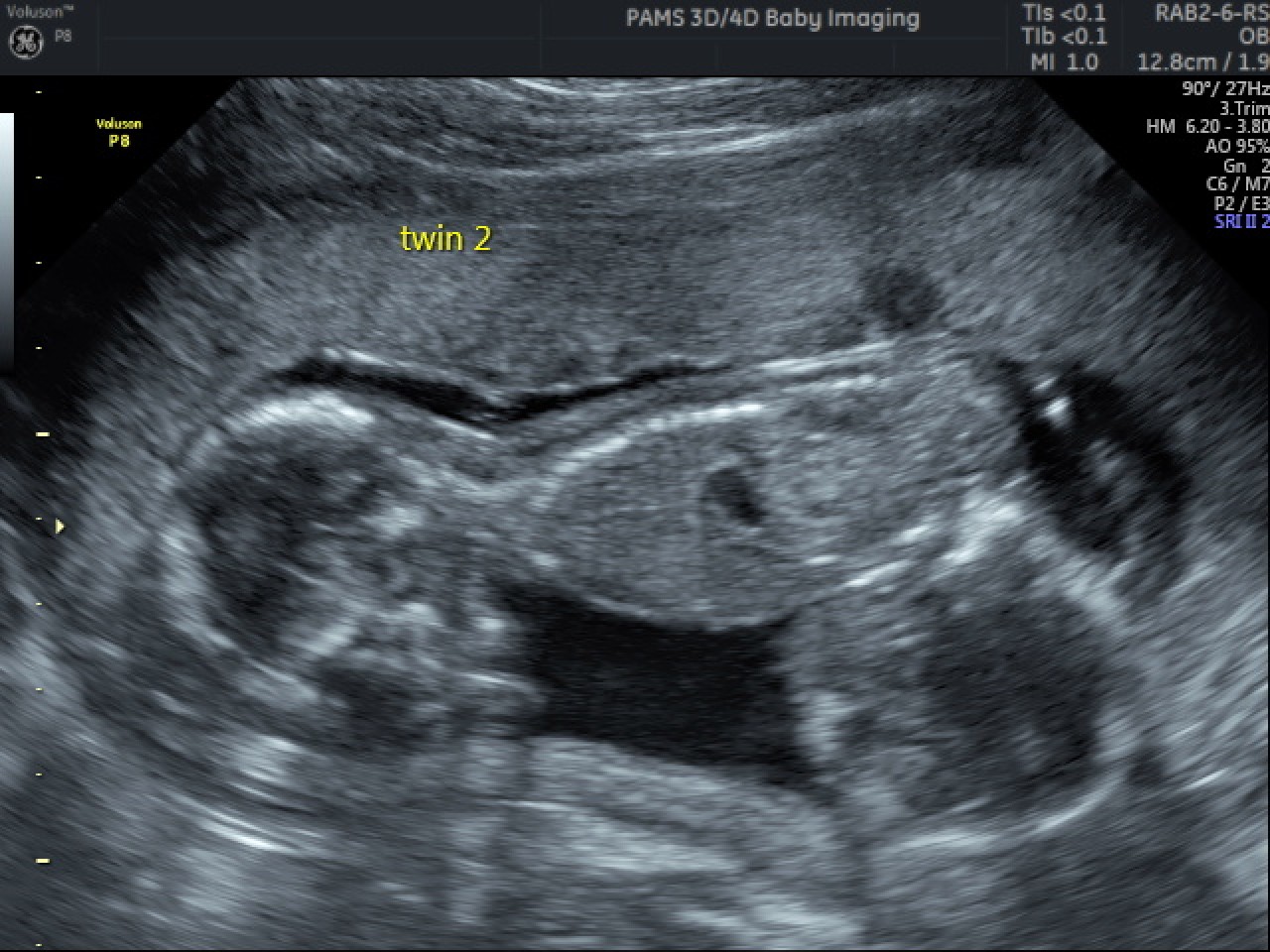 Baby Growth Scan | Private One-On-One Pregnancy & Fertility Ultrasound ...