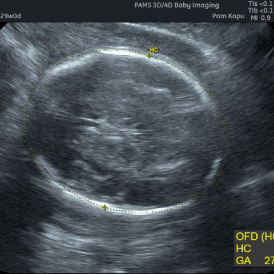 Baby Growth Scan | Private One-On-One Pregnancy & Fertility Ultrasound ...