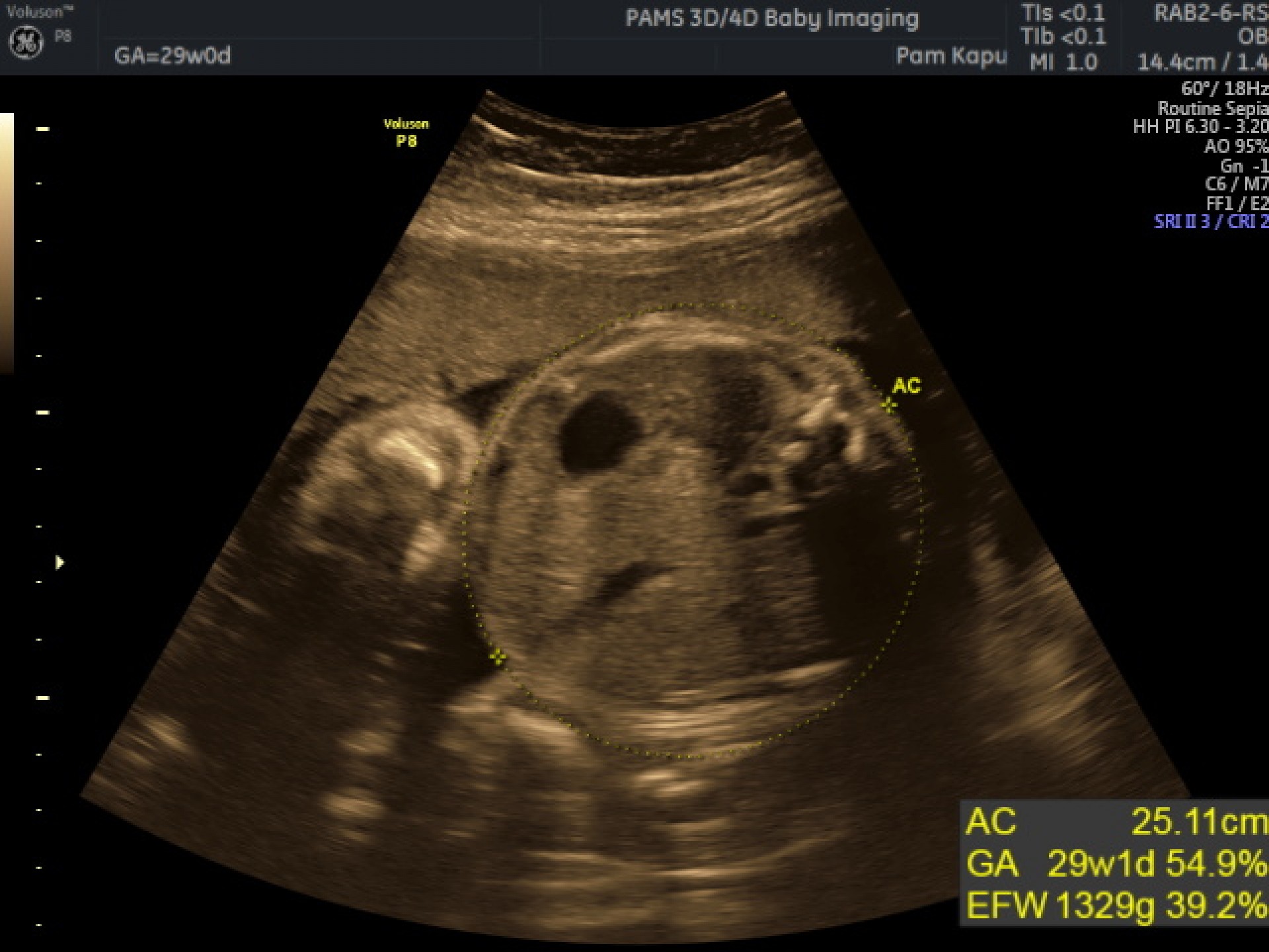 Baby Growth Scan | Private One-On-One Pregnancy & Fertility Ultrasound ...