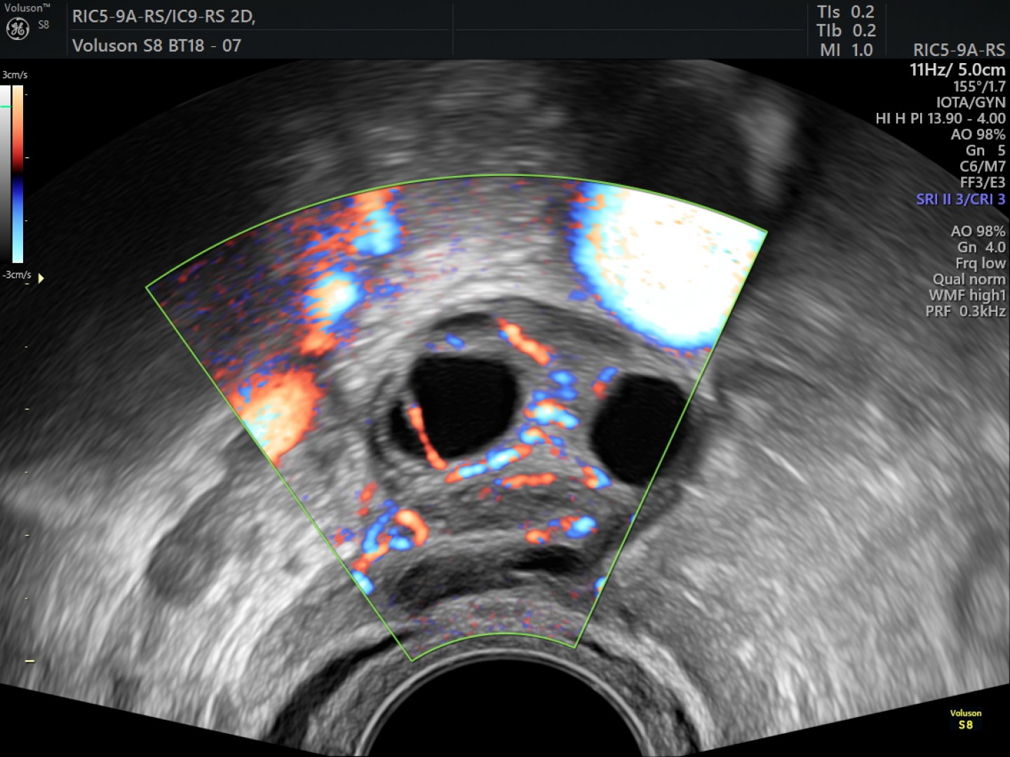 Gynaecological Pelvic Scan | Private One-On-One Pregnancy & Fertility ...