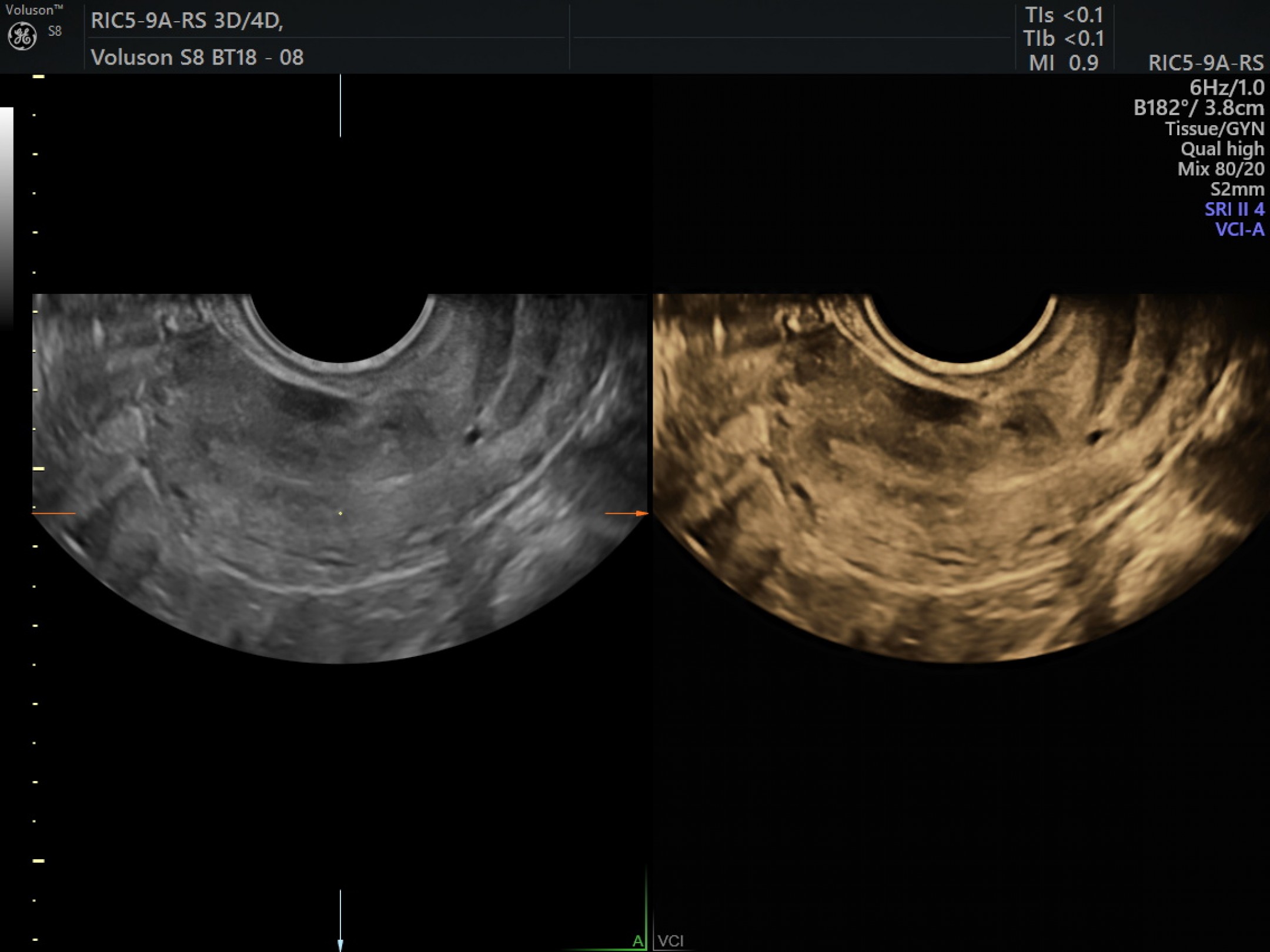 Fertility Scan | Private One-On-One Pregnancy & Fertility Ultrasound ...