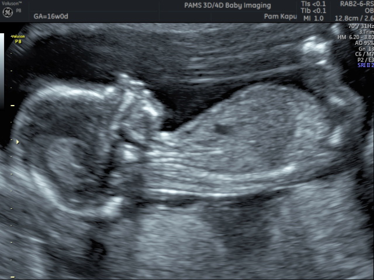 Gender Reveal Scan Private One On One Pregnancy Fertility gender-reveal-scan-private-one-on-one-pregnancy-fertility