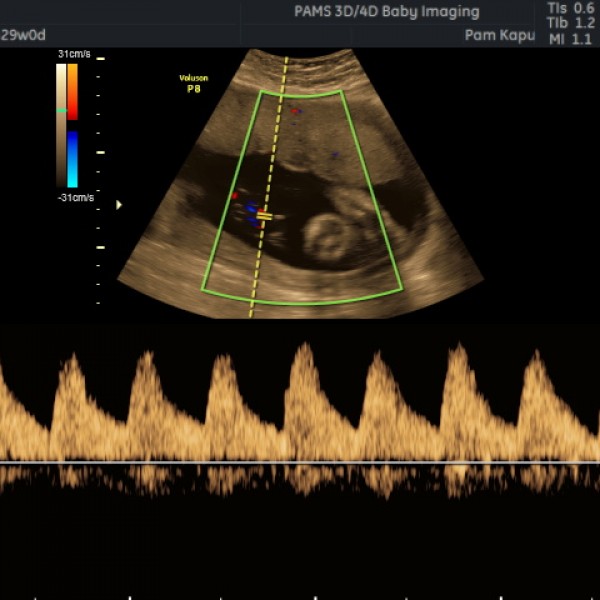 Baby Growth Scan | Private One-On-One Pregnancy & Fertility Ultrasound ...