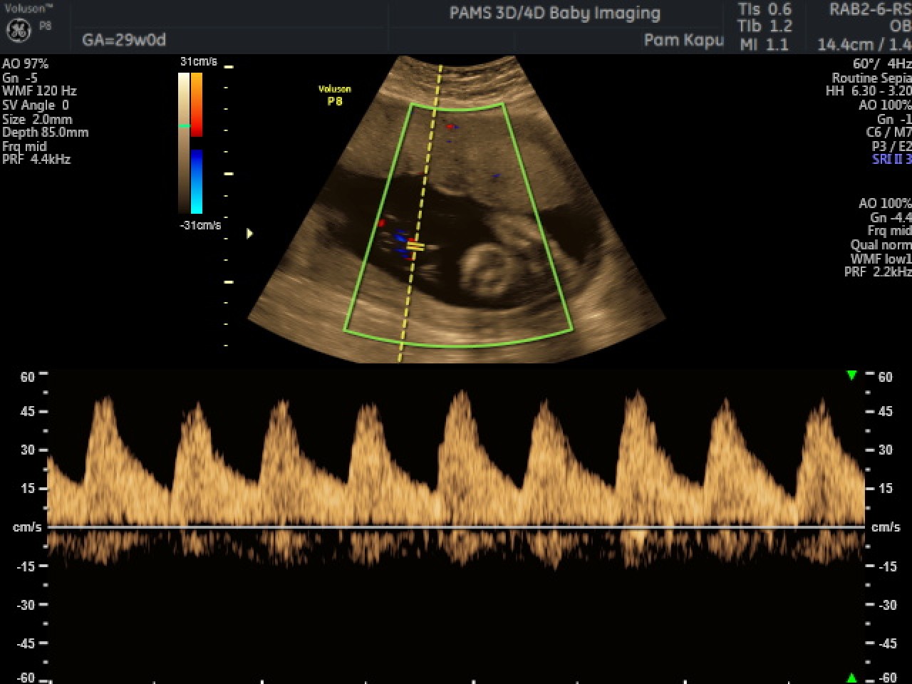 Baby Growth Scan | Private One-On-One Pregnancy & Fertility Ultrasound ...