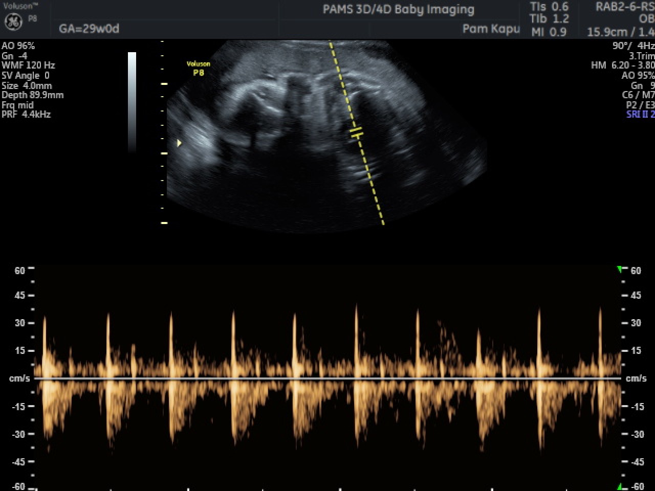 Baby Growth Scan | Private One-On-One Pregnancy & Fertility Ultrasound ...